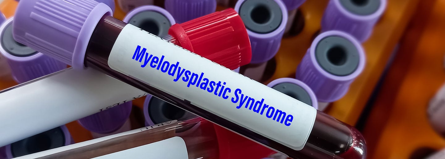 Magrolimab Azacitidine Promising Activity in Higher-Risk MDS Patients | Moffitt