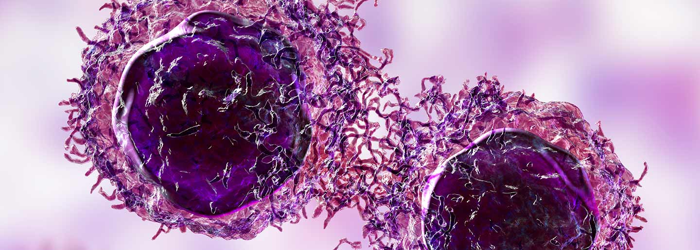 Dual Checkpoint Inhibitor Blockade Shows Promise for Merkel Cell Carci ...