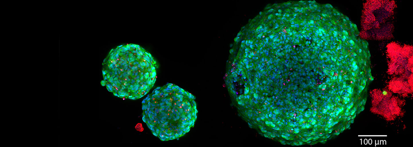 FDA Approves CARVYKTI® and ABECMA for Early Treatment of Adult Patients ...